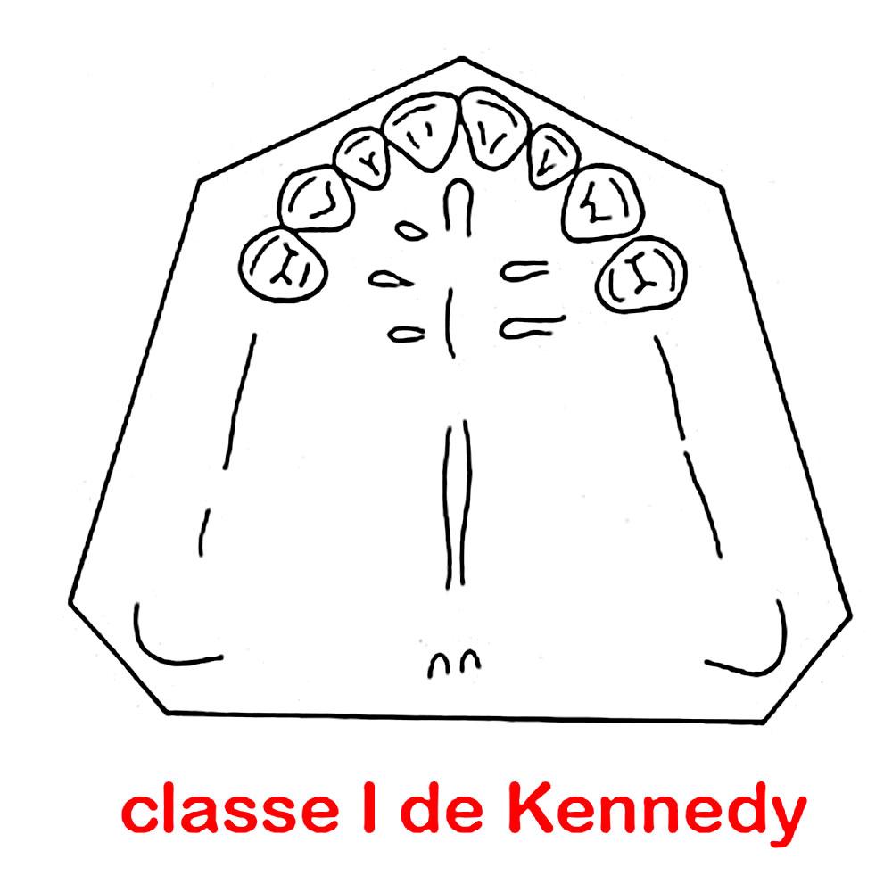 Classe De Kennedy I - INJSP